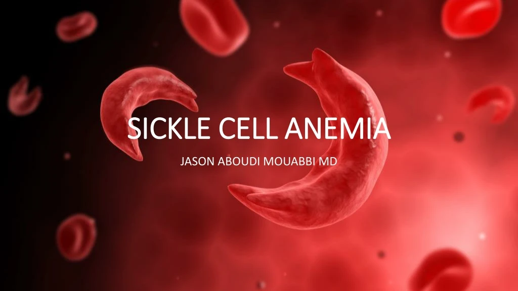 PPT - SICKLE CELL ANEMIA PowerPoint Presentation, free download - ID ...