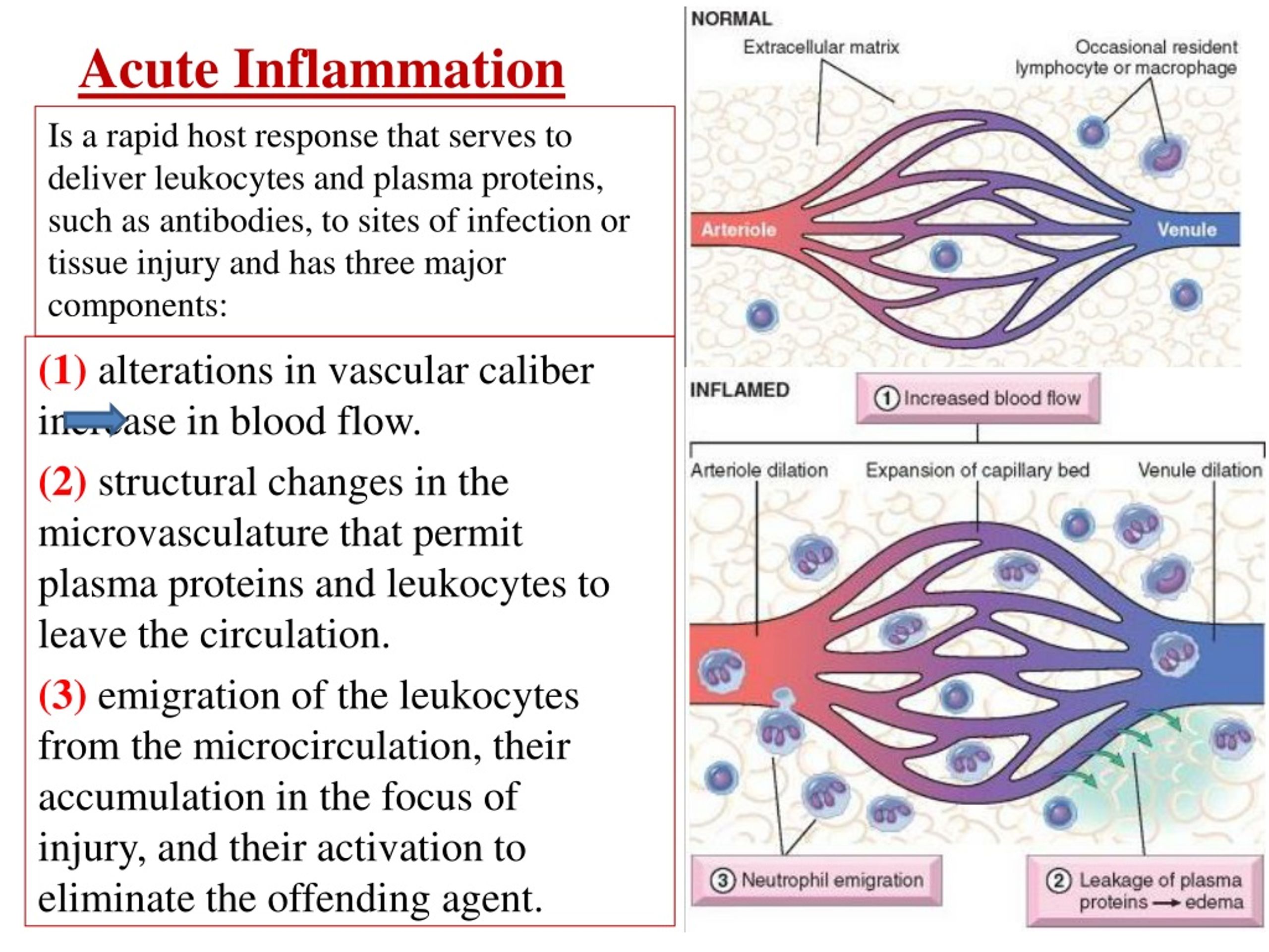PPT General Pathology Chapter 2 Acute And Chronic Inflammation