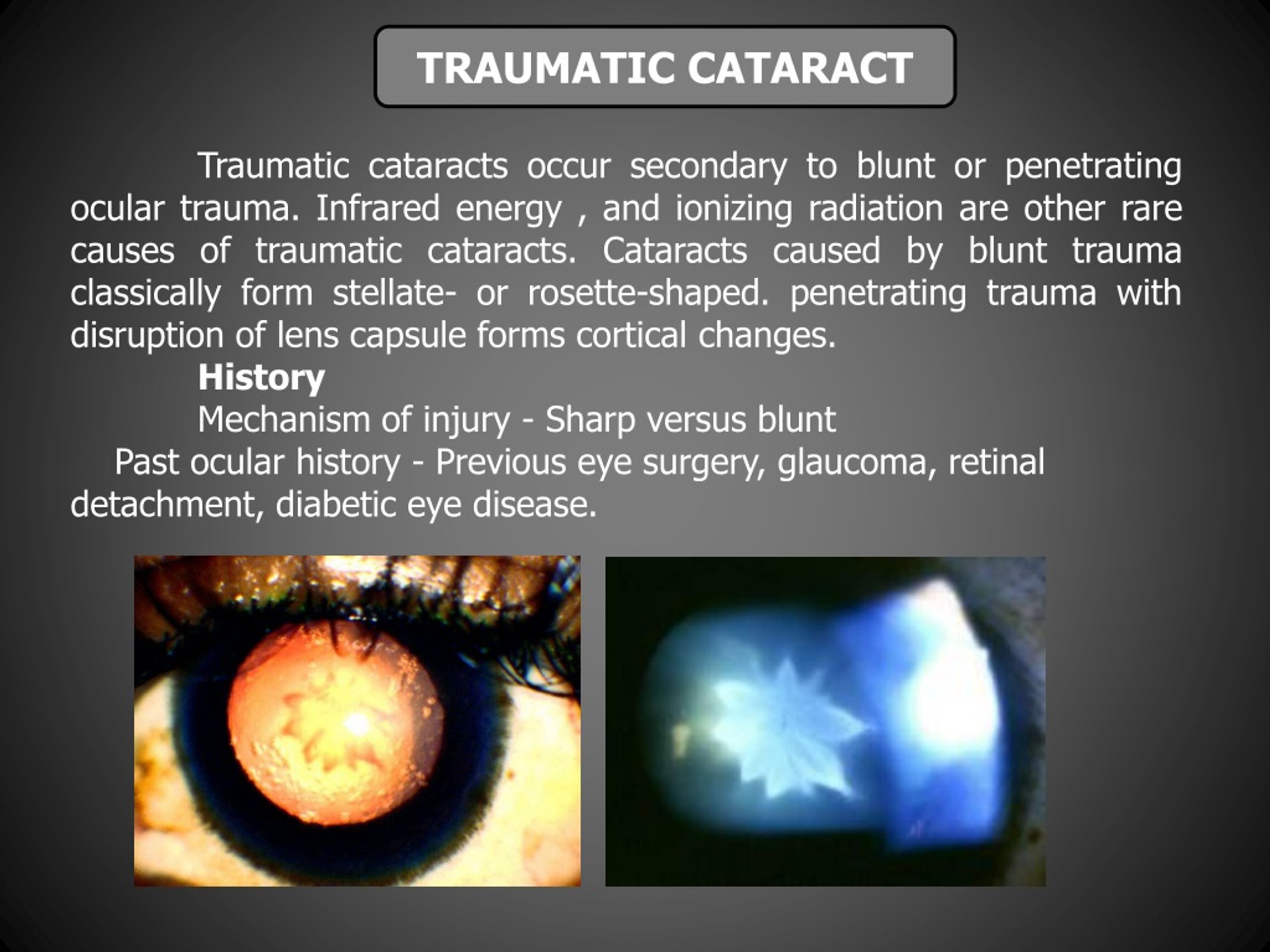 PPT Comprehensive Guide To Ocular Trauma Diagnosis And Treatment PPT Comprehensive Guide To Ocular Trauma Diagnosis And Treatment