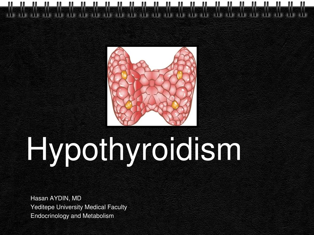 PPT - Hypothyroidism PowerPoint Presentation, free download - ID:9105421