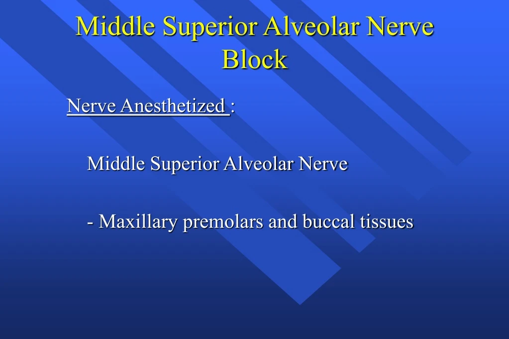PPT - Middle Superior Alveolar Nerve Block PowerPoint Presentation ...