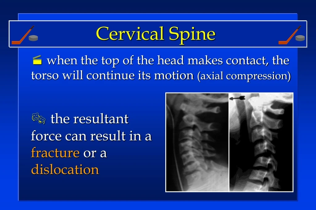 PPT - Cervical Spine PowerPoint Presentation, free download - ID:9149791