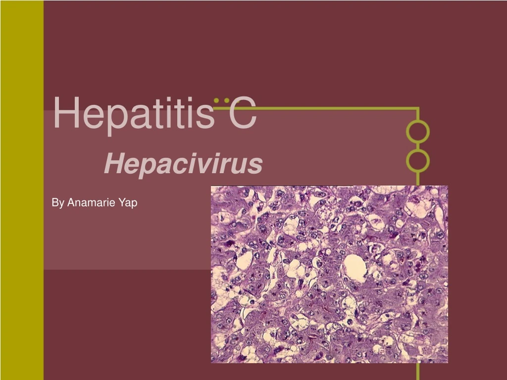 PPT - Hepatitis C Hepacivirus PowerPoint Presentation, free download ...