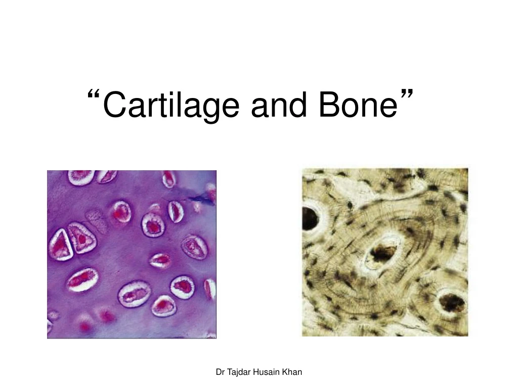 PPT - “ Cartilage and Bone ” PowerPoint Presentation, free download ...