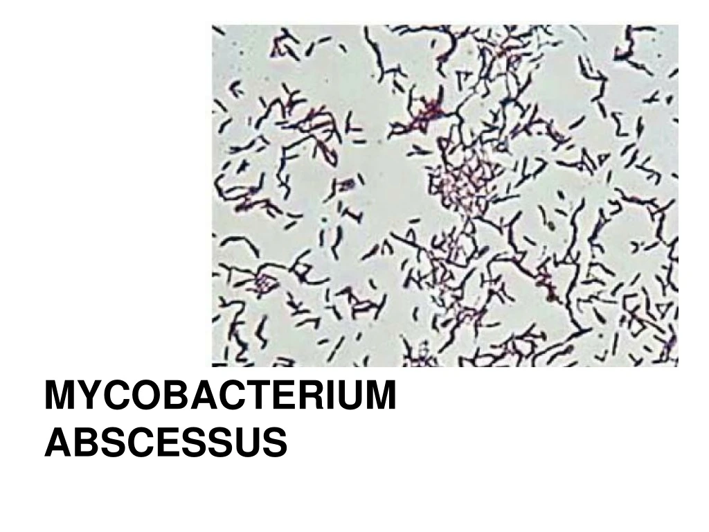 PPT - MYCOBACTERIUM ABSCESSUS PowerPoint Presentation, free download ...