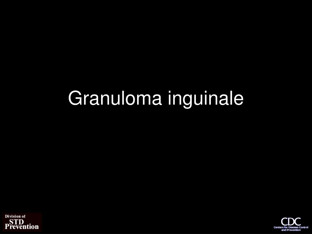 PPT - Granuloma inguinale PowerPoint Presentation, free download - ID ...