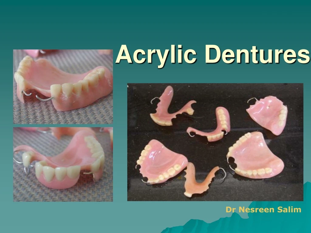 PPT - Acrylic Dentures PowerPoint Presentation, free download - ID:9236302