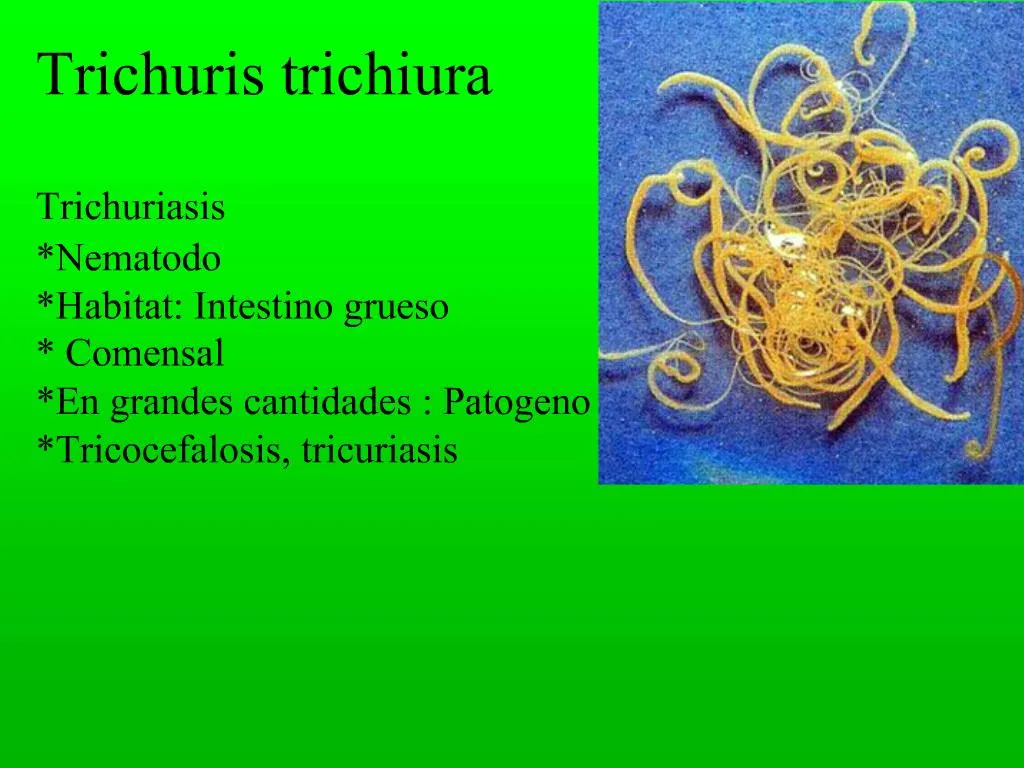 PPT - Trichuris trichiura Trichuriasis *Nematodo *Habitat: Intestino ...