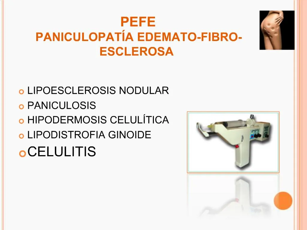 PPT - PEFE PANICULOPAT A EDEMATO-FIBRO-ESCLEROSA PowerPoint ...