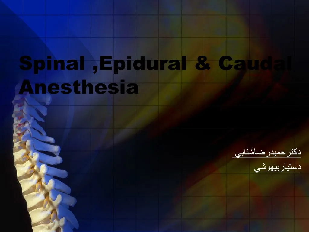 PPT - Spinal ,Epidural & Caudal Anesthesia PowerPoint Presentation - ID ...
