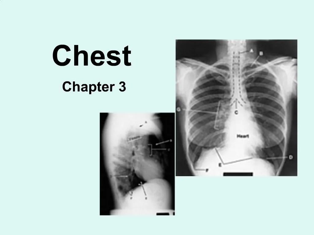 PPT - Chest PowerPoint Presentation, free download - ID:986984